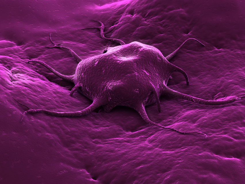 Leuven scientists battle cancer by starving cells | The Bulletin